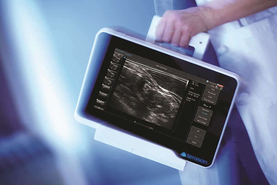 Terason U Smart 3200T นวัตกรรมอัลตราซาวด์แห่งปี