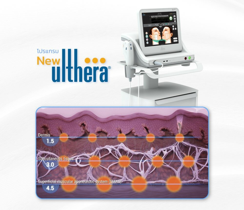 Ulthera นวัตกรรมยกกระชับ ช่วยใบหน้าให้ดูเด็กลงอย่างเห็นผล โดยไม่ต้องผ่าตัด