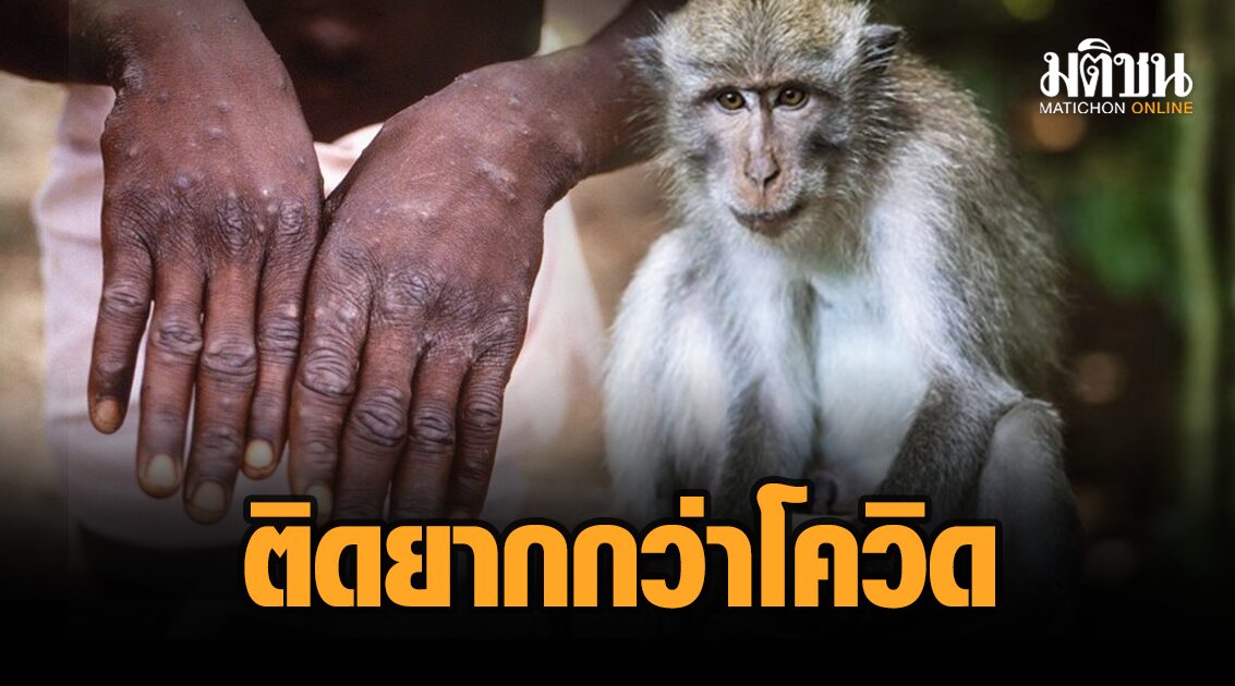 Genome Center confirms monkeypox research results are more difficult to ...