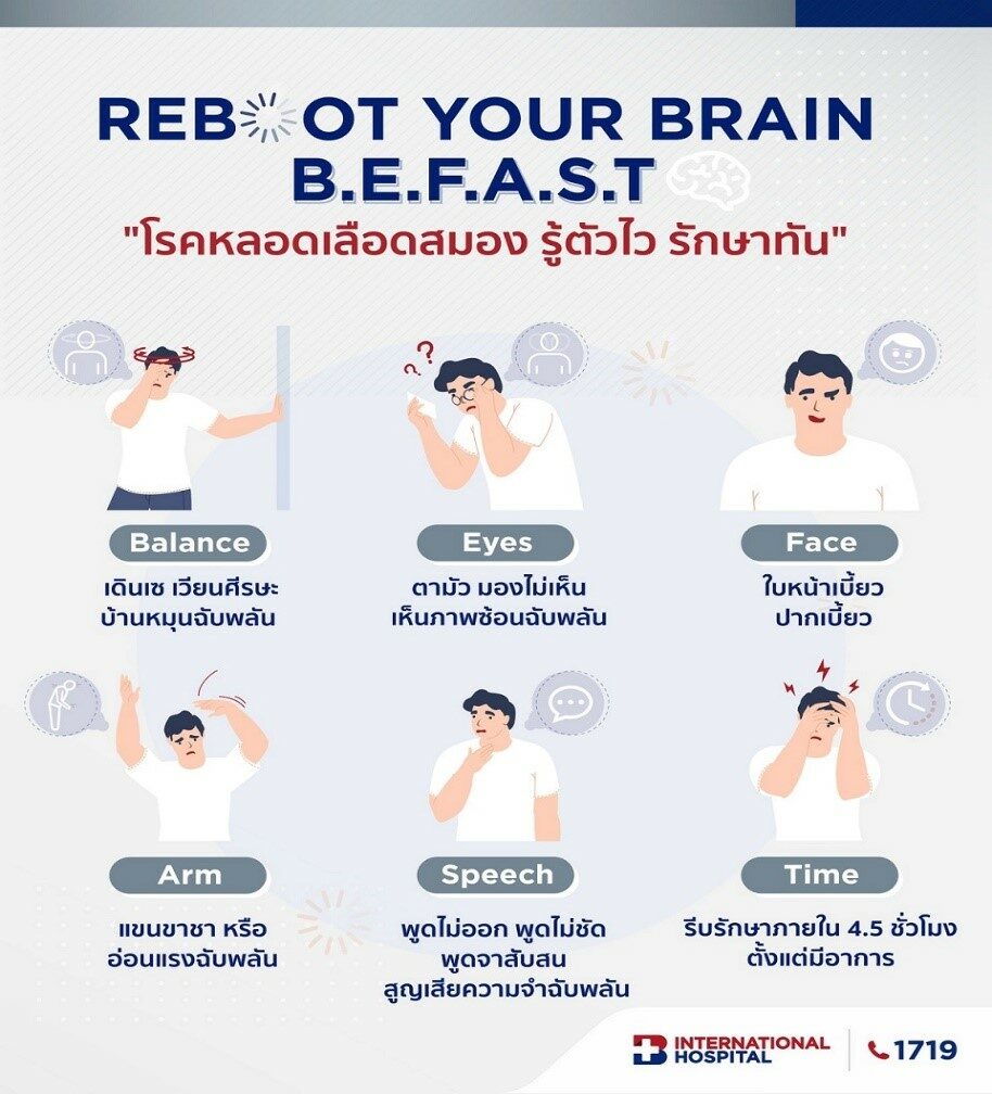 สังเกตอาการเตือนโรคหลอดเลือดสมอง ตามหลักการ BEFAST รู้ไว ปลอดภัยจากโรค ...